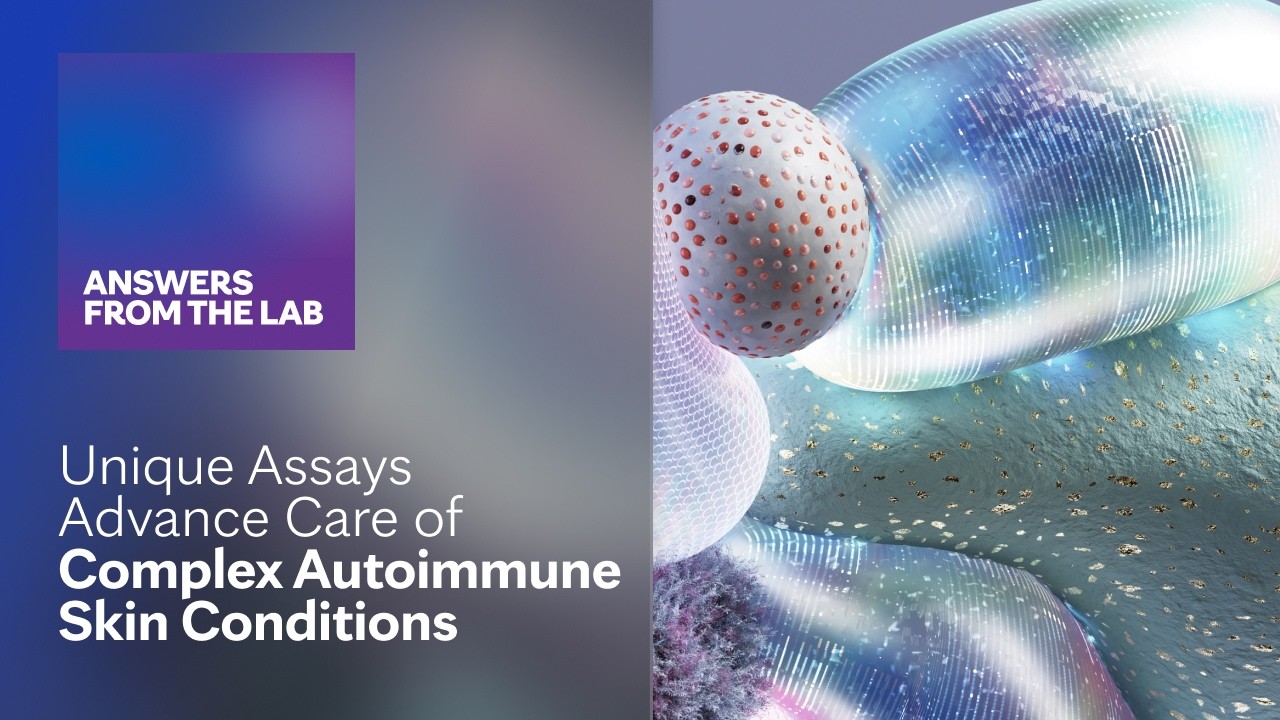 Unique Assays Advance Care of Complex Autoimmune Skin Conditions