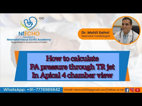 How to calculate pulmonary artery pressure through Tricuspid jet in Apical 4 chamber view