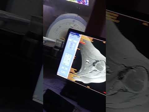 training time #beginners #anatomy #mri #like #medicine #subscribe #medicine #brain #mri