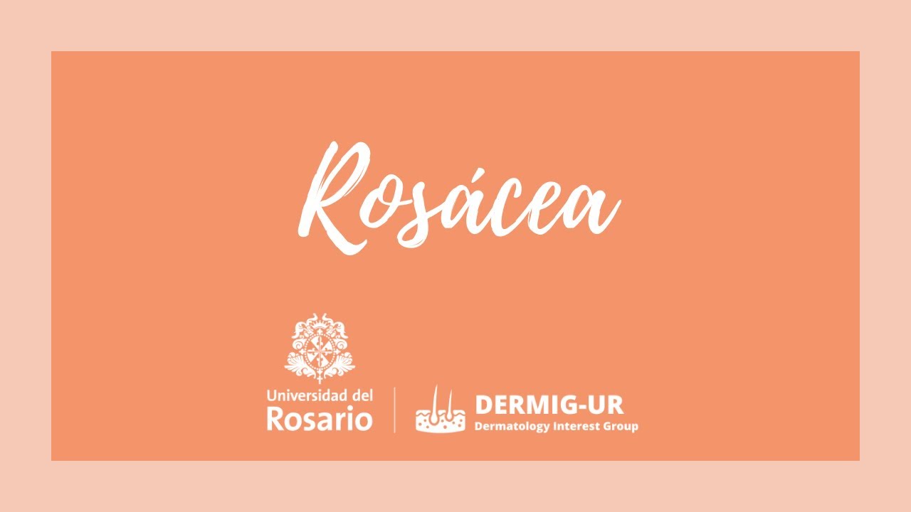 Rosácea