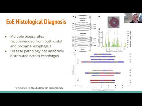 4/11/23 Eosinophilic Esophagitis: The Role of the Allergist/Immunologist