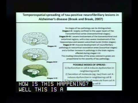 It Takes Tau to Tangle : Plaques, Tangles and Neurodegenerative Disease