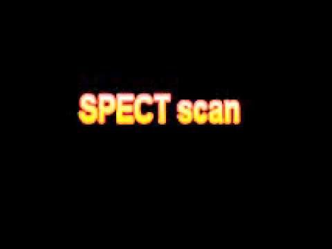 What Is The Definition Of SPECT scan Medical School Terminology Dictionary