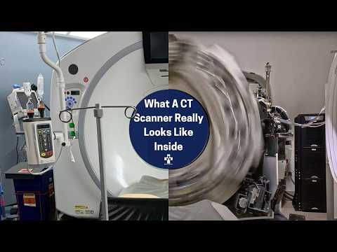 How Fast Does A CT Scan Machine Spin? World's Fastest CAT Scanner Spinning Max Speed