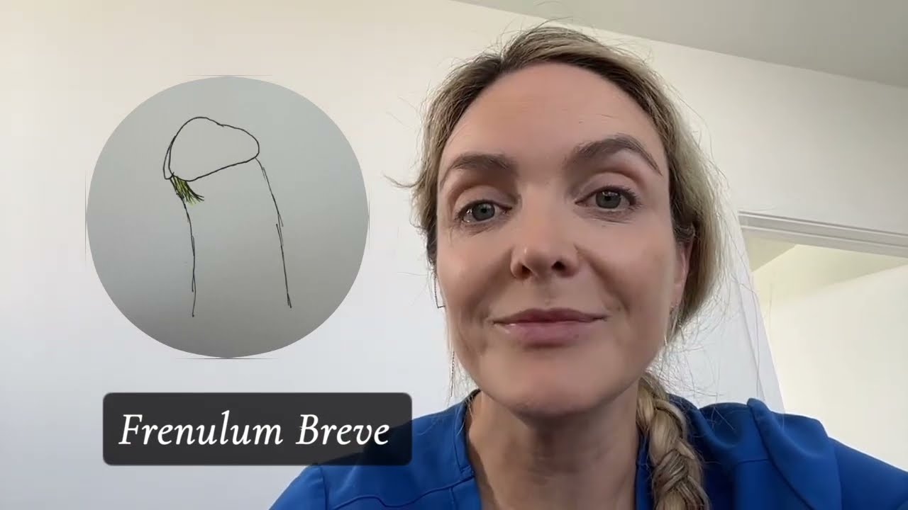 Frenulum Breve
