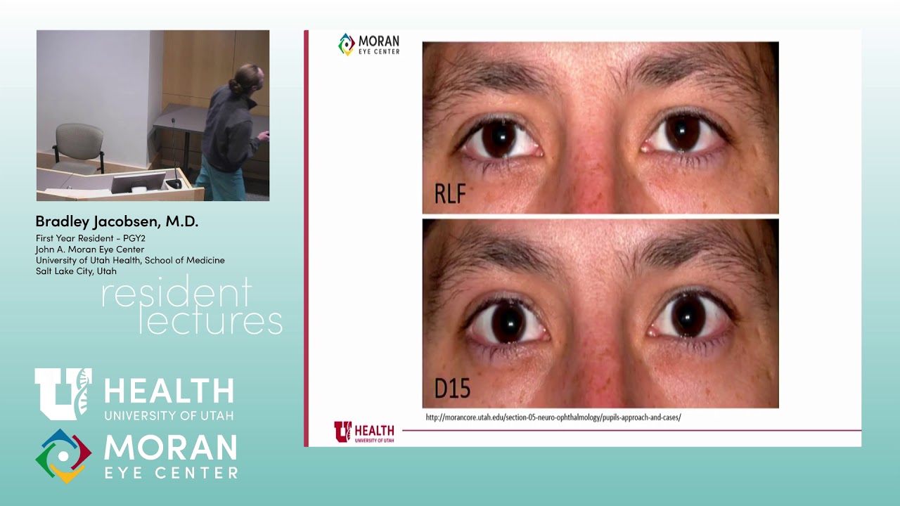 Pupil Anatomy and Cases [ARCHIVE]