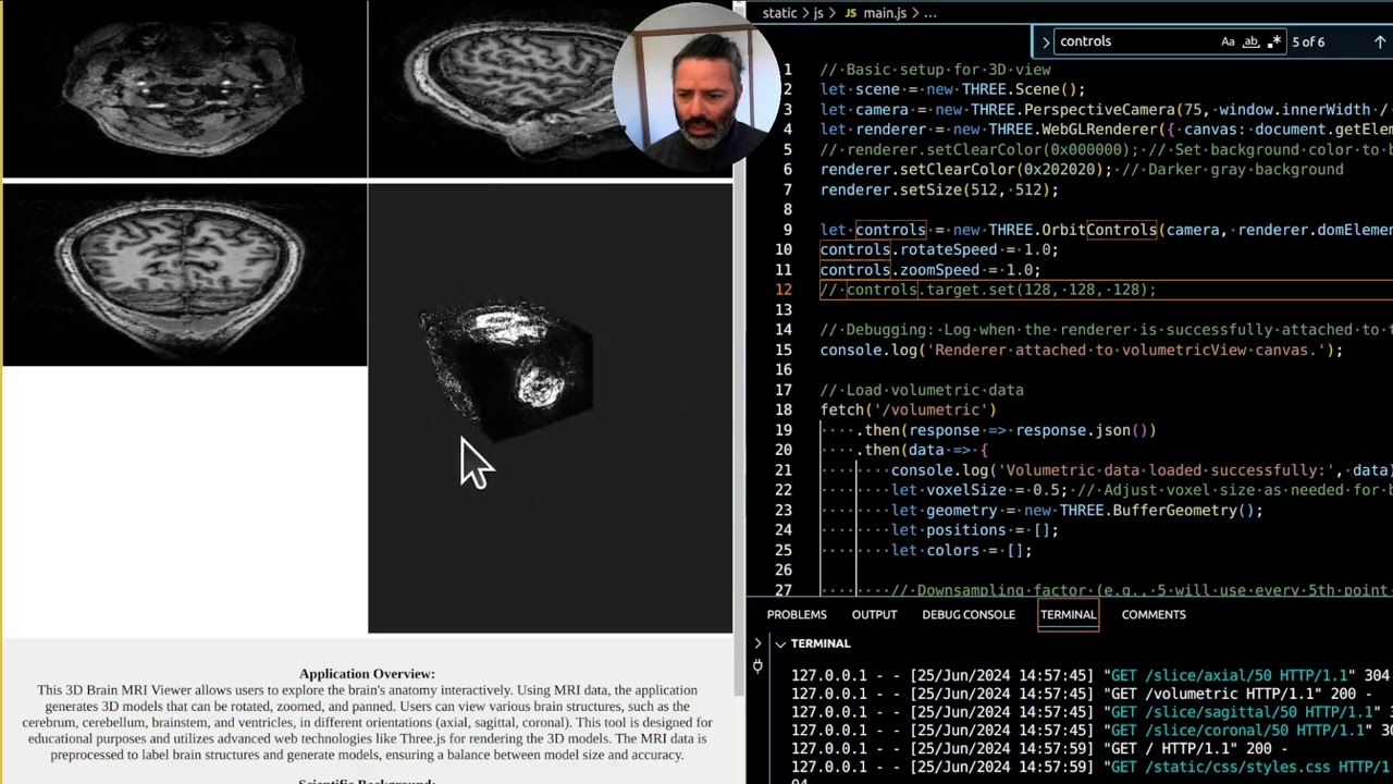 Fixing Volumetric Data & Lighting in 3D Brain Model: Enhancing Visuals and Mouse Control
