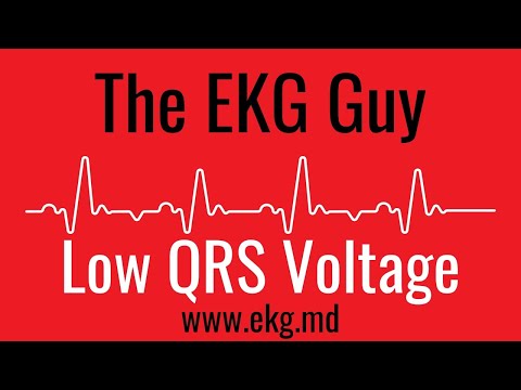 Low QRS Voltage on EKG / ECG l The EKG Guy - www.ekg.md