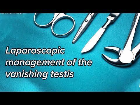 Laparoscopic management of the vanishing testis | Cryptorchidism