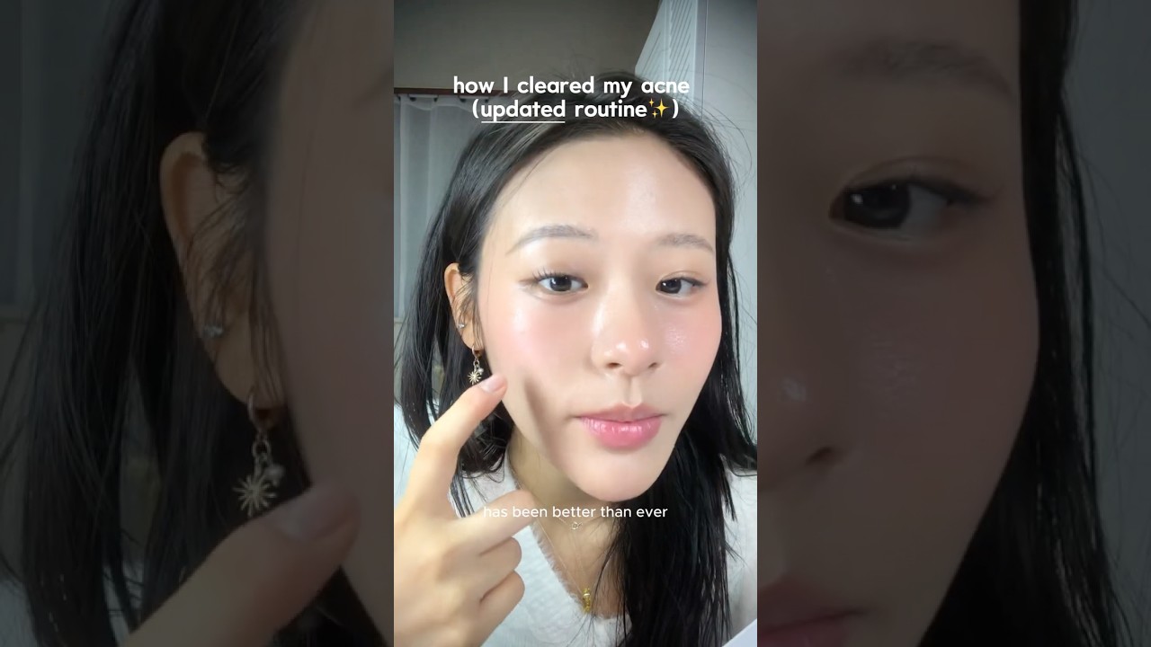 *not sponsored* how I cleared my acne (updated routine)✨