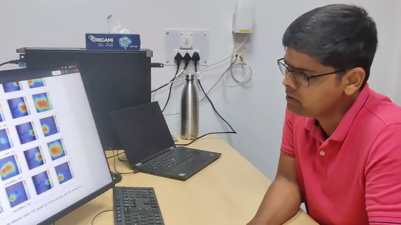 Research Stories: AI-based model to Predict Knee Osteoarthritis Severity from X-ray Images