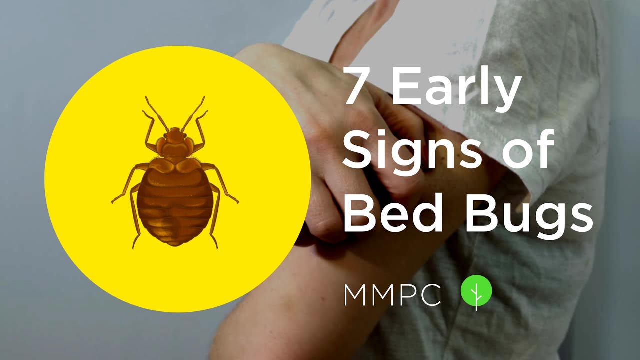 7 Early Signs of BED BUGS (How to Know if You Have Bed Bugs)