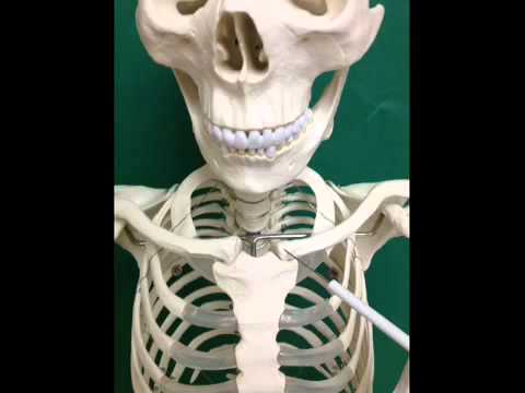 Upper Limb Markings Quiz