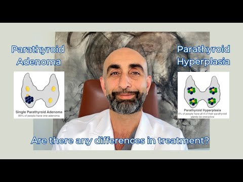 Parathyroid adenoma vs parathyroid hyperplasia | Is there a difference in treatment?