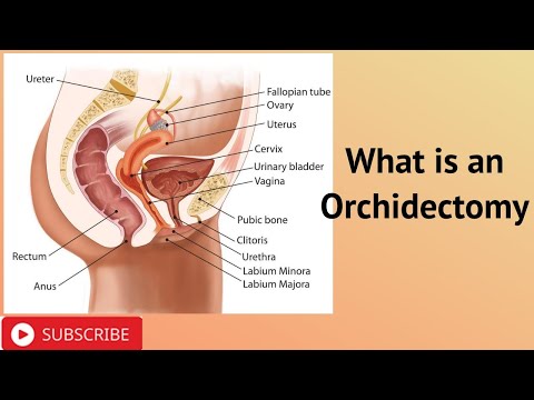 What is an Orchidectomy
