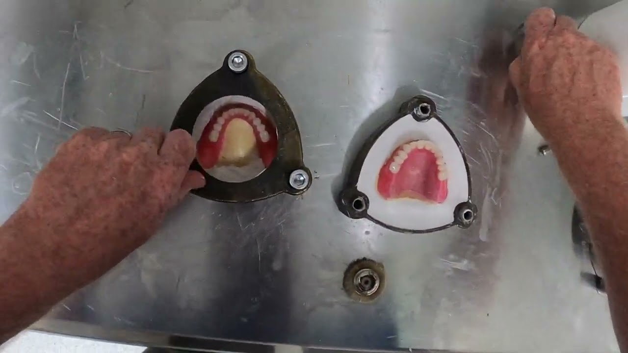 Complete Denture Course: Flasking, Packing and Processing