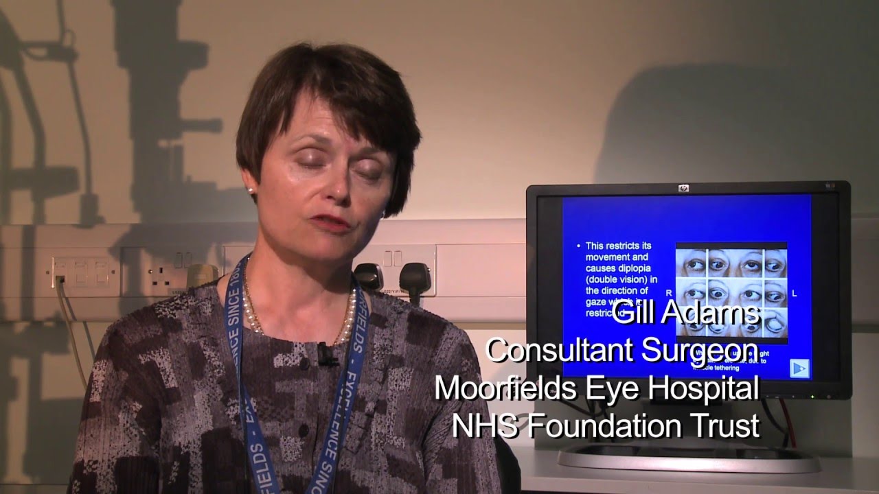 TED (Thyroid Eye Disease) - 