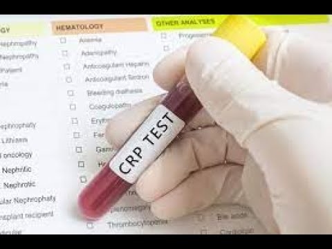 Pathology CPT codes Immunology Part 1 - simplify medical coding