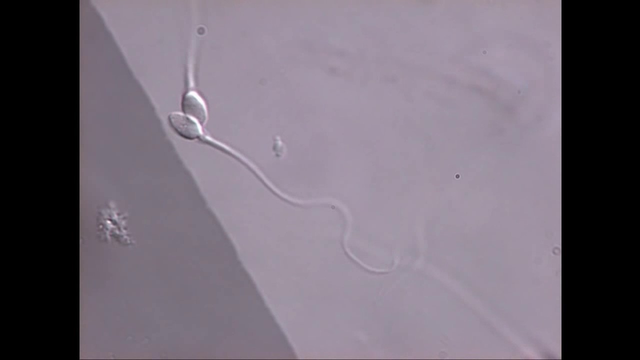 Sperm swimming in microscope field