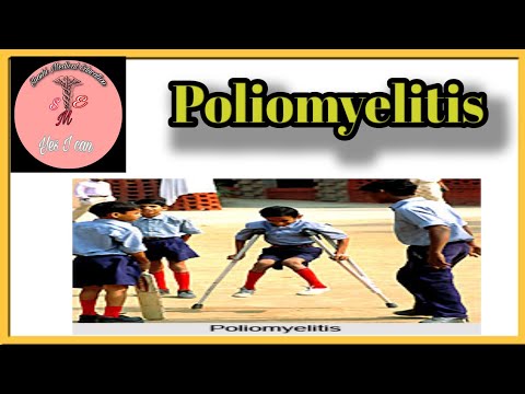 Polio Disease (Poliomyelitis) | Causes, symptoms, treatment & prevention |