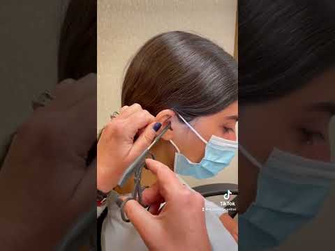 Invisible hearing aid #lyric#audiology #audiologycentral