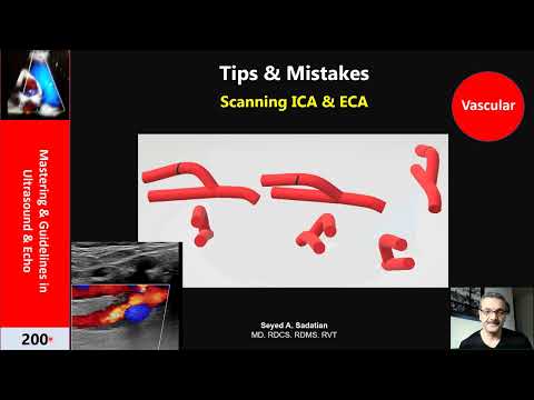 announcement :Tips & Mistakes: Scanning ECA & ICA