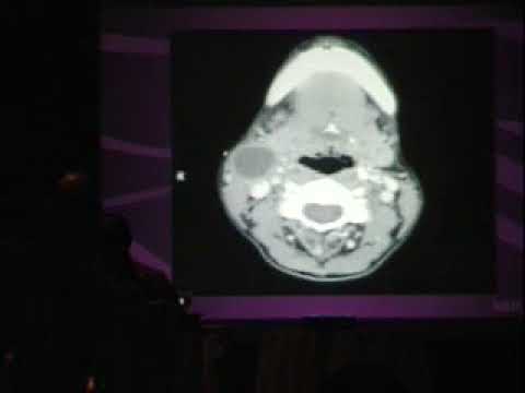ENT and eye radiology Dr Lev great