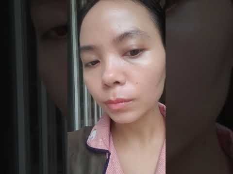 3 tháng dùng retinol obagi #ketquasudungretinol #3thangretinol #retinol #obagi #jackfruitskincare