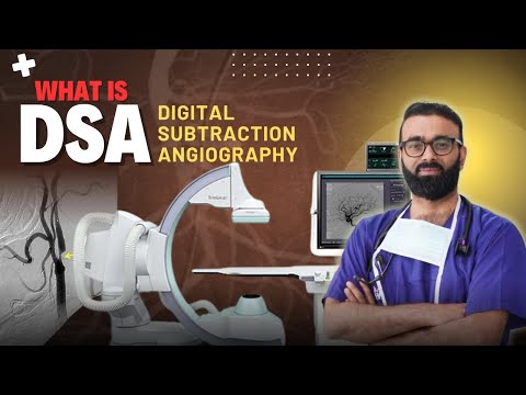 What is Digital Subtraction Angiography (DSA)? | Brain Imaging Explained by Dr. Biplab Das