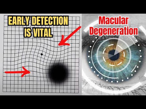 Detect Early Signs of Macular Degeneration with the Amsler Grid Test