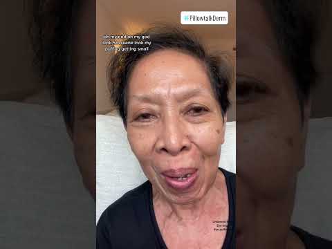 Miracle Eye Bag Treatment?! #shorts