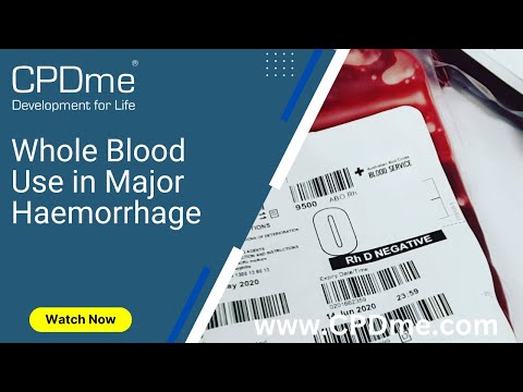Whole Blood Use in Major Haemorrhage Presented By Prof Jason Smith