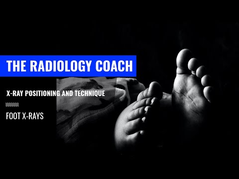 How to SHOOT FOOT X-RAYS