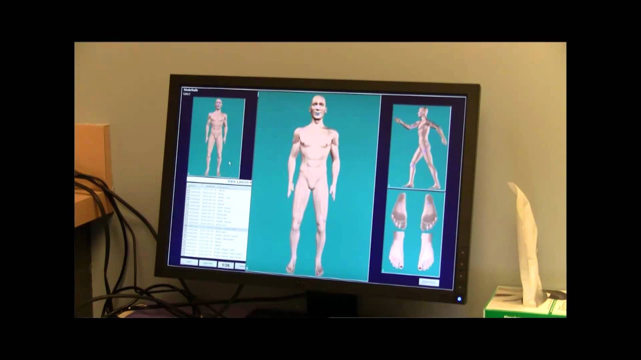 How Mole Mapping Works