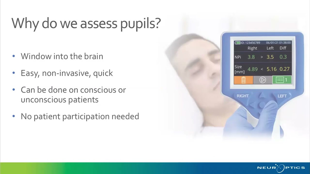 Pupillometry and NPi® in the Neuro ICU