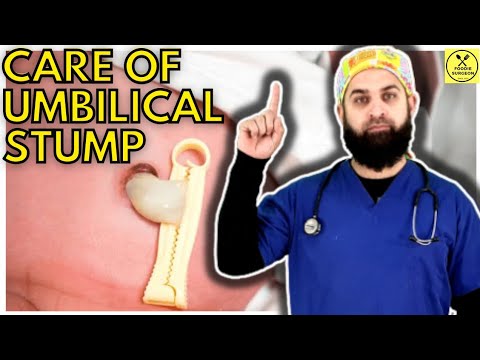 Care of Umbilical CORD in Newborn | Naaf ki safayi kesy karain?