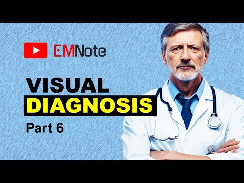 Visual Diagnosis Part 6