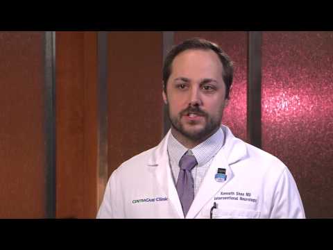 Meet Kenneth J. Shea, MD, interventional neurologist