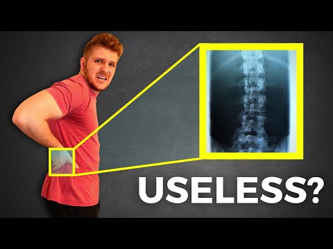 Should You Get Imaging for Back Pain? (MRI, X-Ray, Scans, Etc)