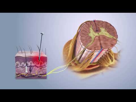 Sensorimotor neuropathy