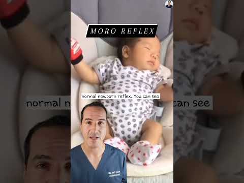 Are you Aware of THIS Shocking Childhood Epilepsy?! #shorts