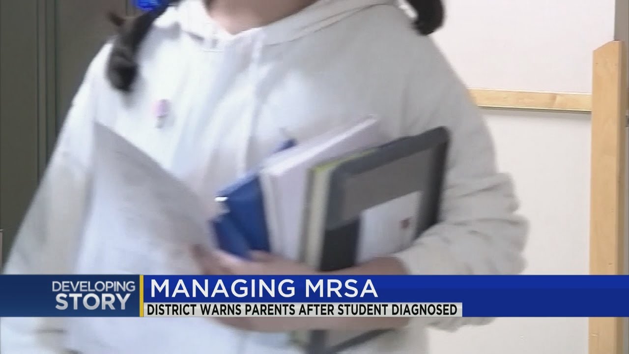 Local student diagnosed with MRSA