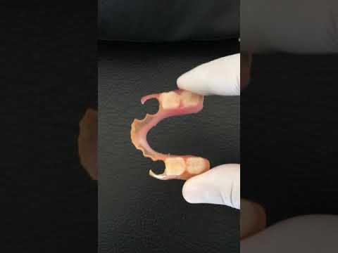 Flexible Dentures