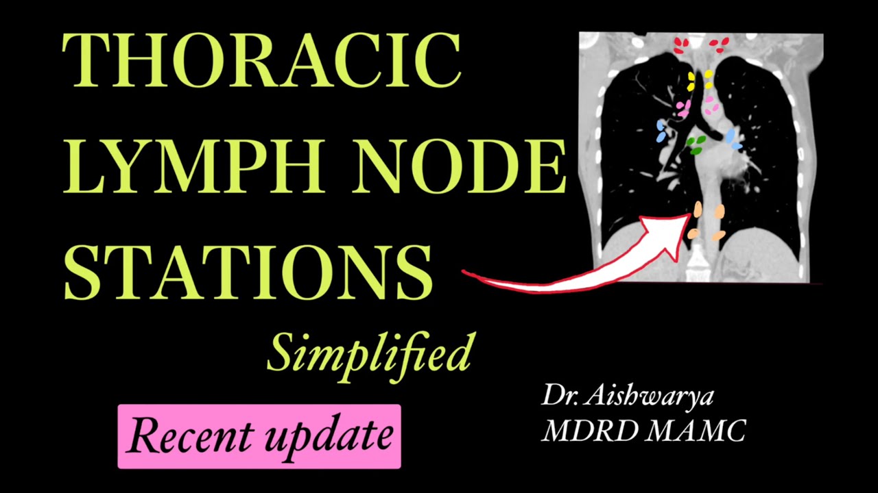 THORACIC LYMPH NODE STATIONSl Simplified l Updated IASLC Zones & Stations l