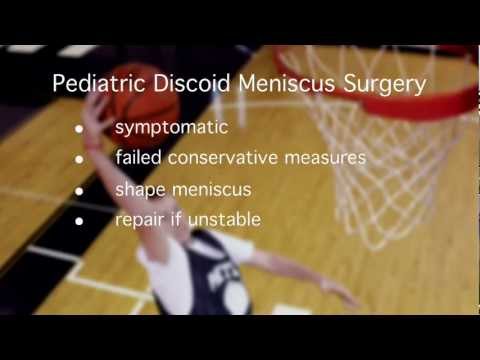 Pediatric Discoid Meniscus Surgery