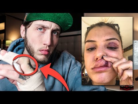 FaZe Banks Opens Up About the Night Alissa Violet Was Punched In The Face