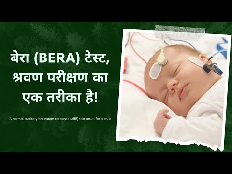 "What is BERA Test? Comprehensive Overview for Hearing Diagnosis