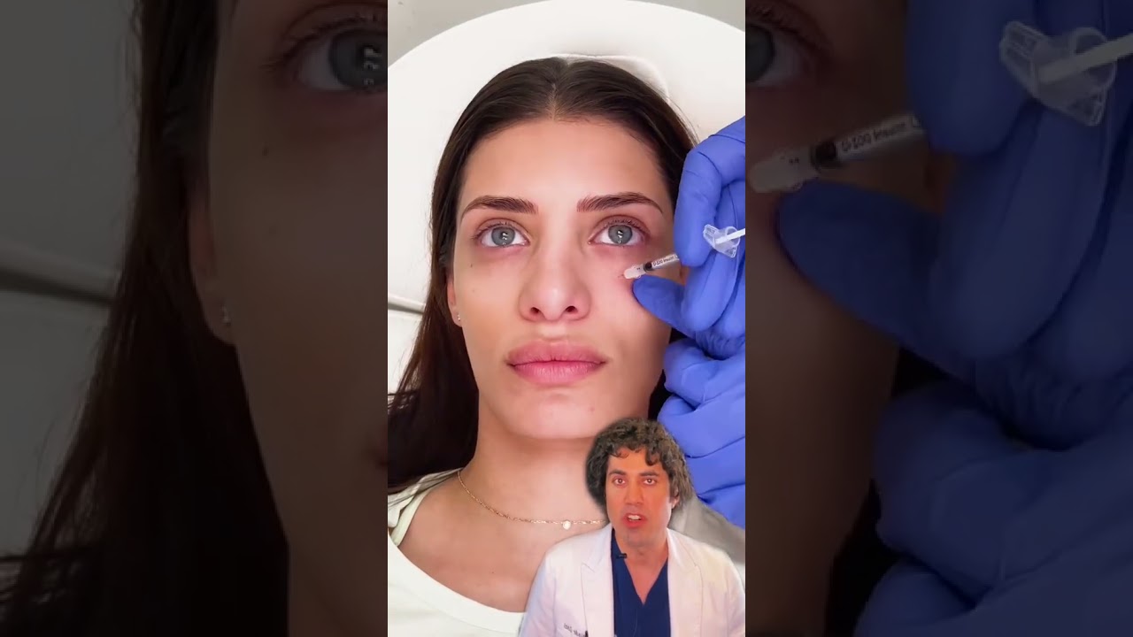 One of the BEST Treatments for Sunken Under Eyes and Dark Circles (INSTANT Results!)
