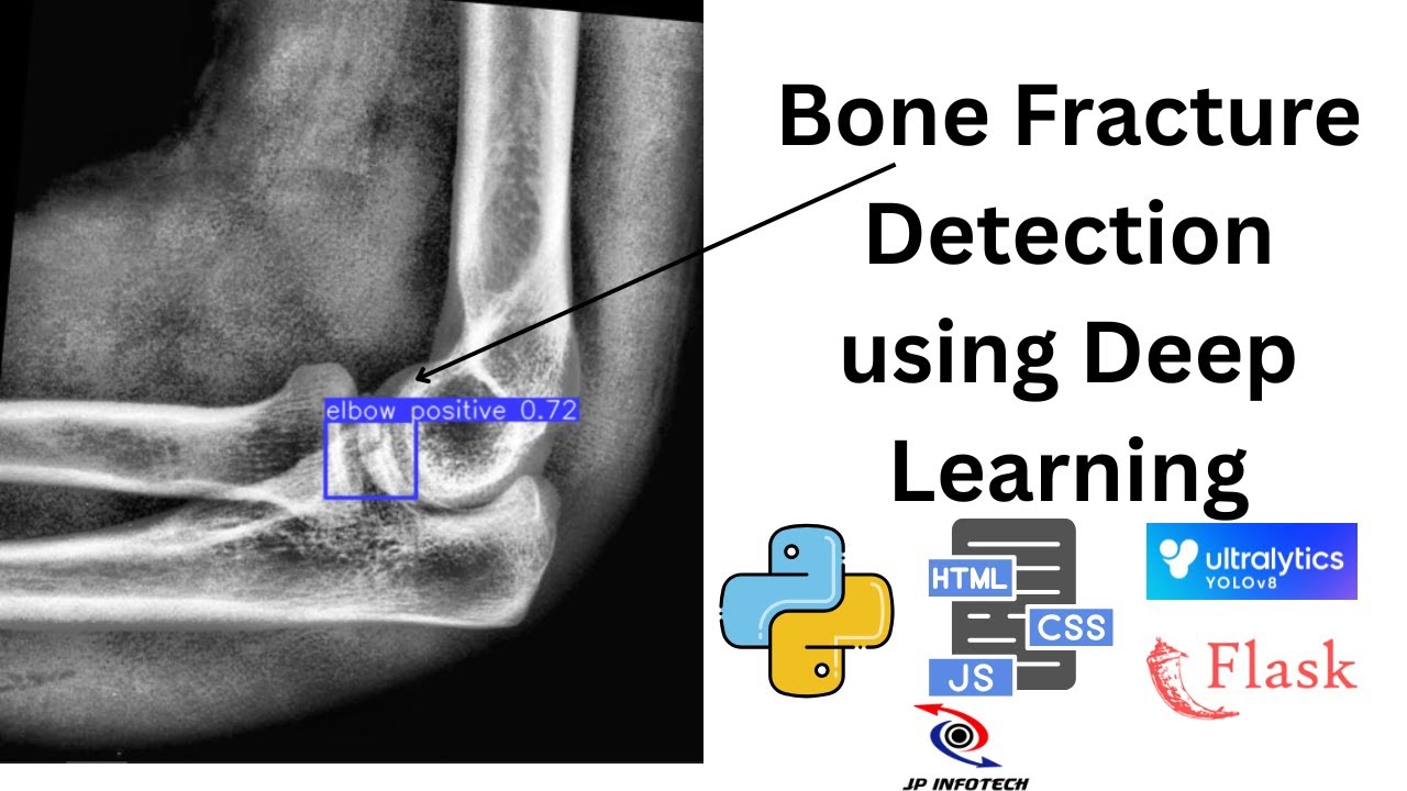 Bone Fracture Detection using Deep Learning | Python Final Year IEEE Project