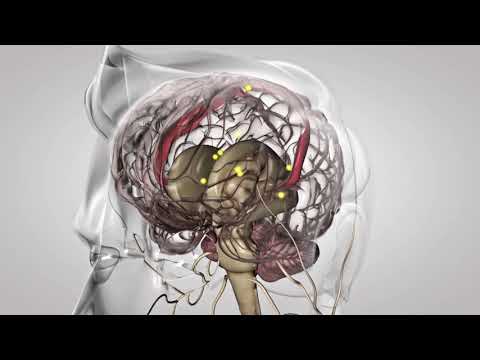 What is Bovine Spongiform Encephalopathy?